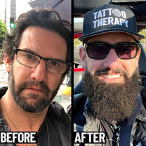 Beard Shampoo | Beard Shampoo and Conditioner | Derm Dude